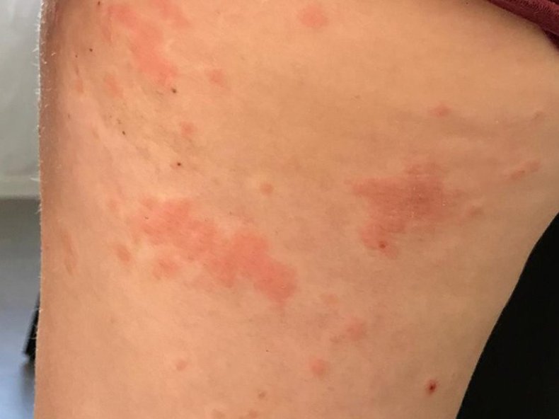 The oak processionary moth – background knowledge and recommended ...